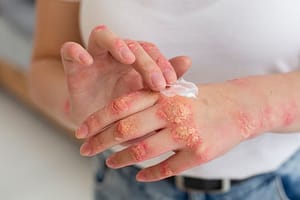 Common White Bread Intolerance Symptoms | IntoleranceLab